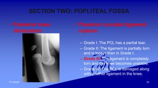 Anatomy of the Adductor Canal and popliteal fossa.pptx