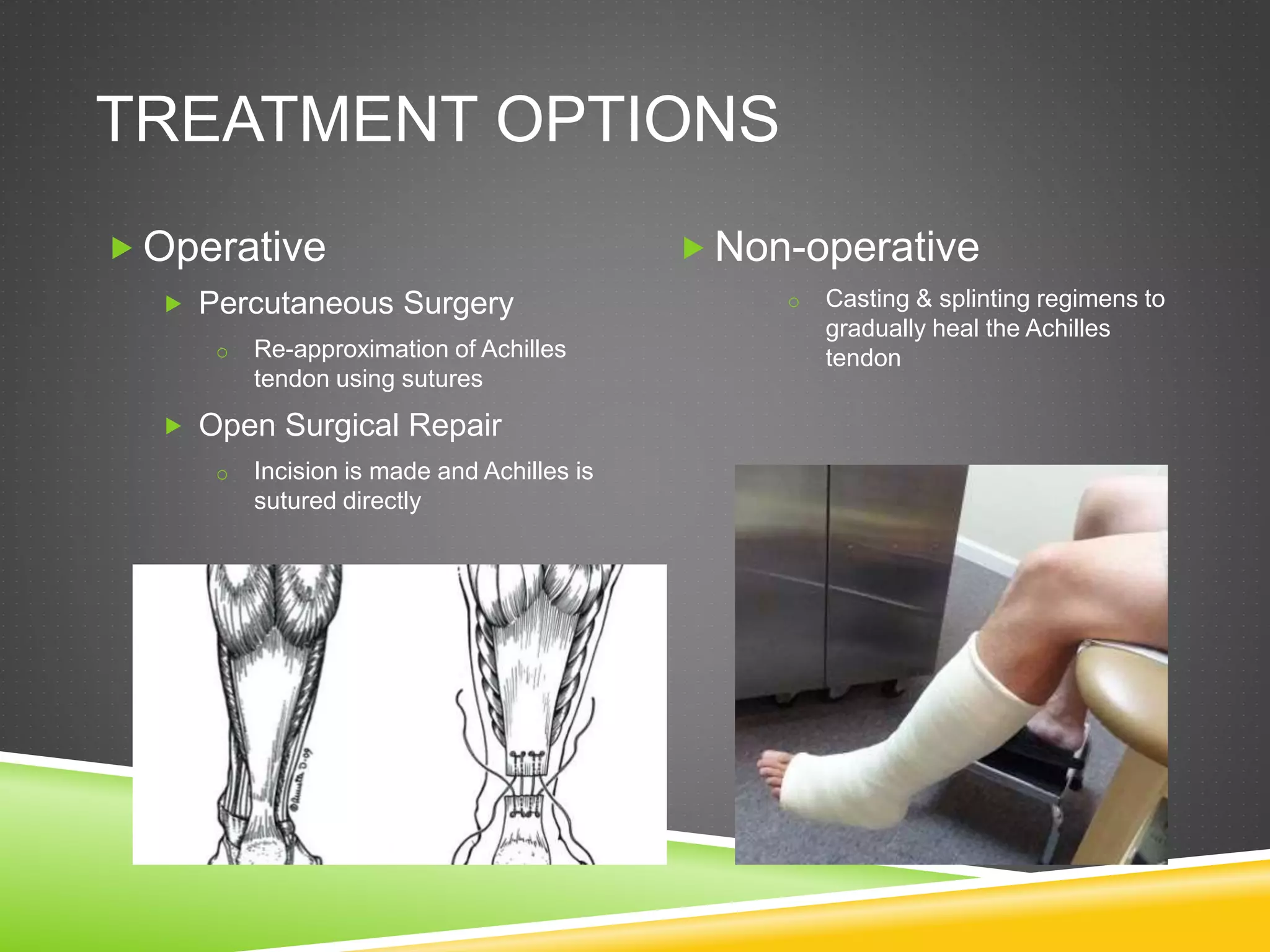 Achilles Tendon Presentation2013 | PPTX