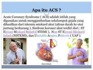 Sindrom Koroner Akut.ppt