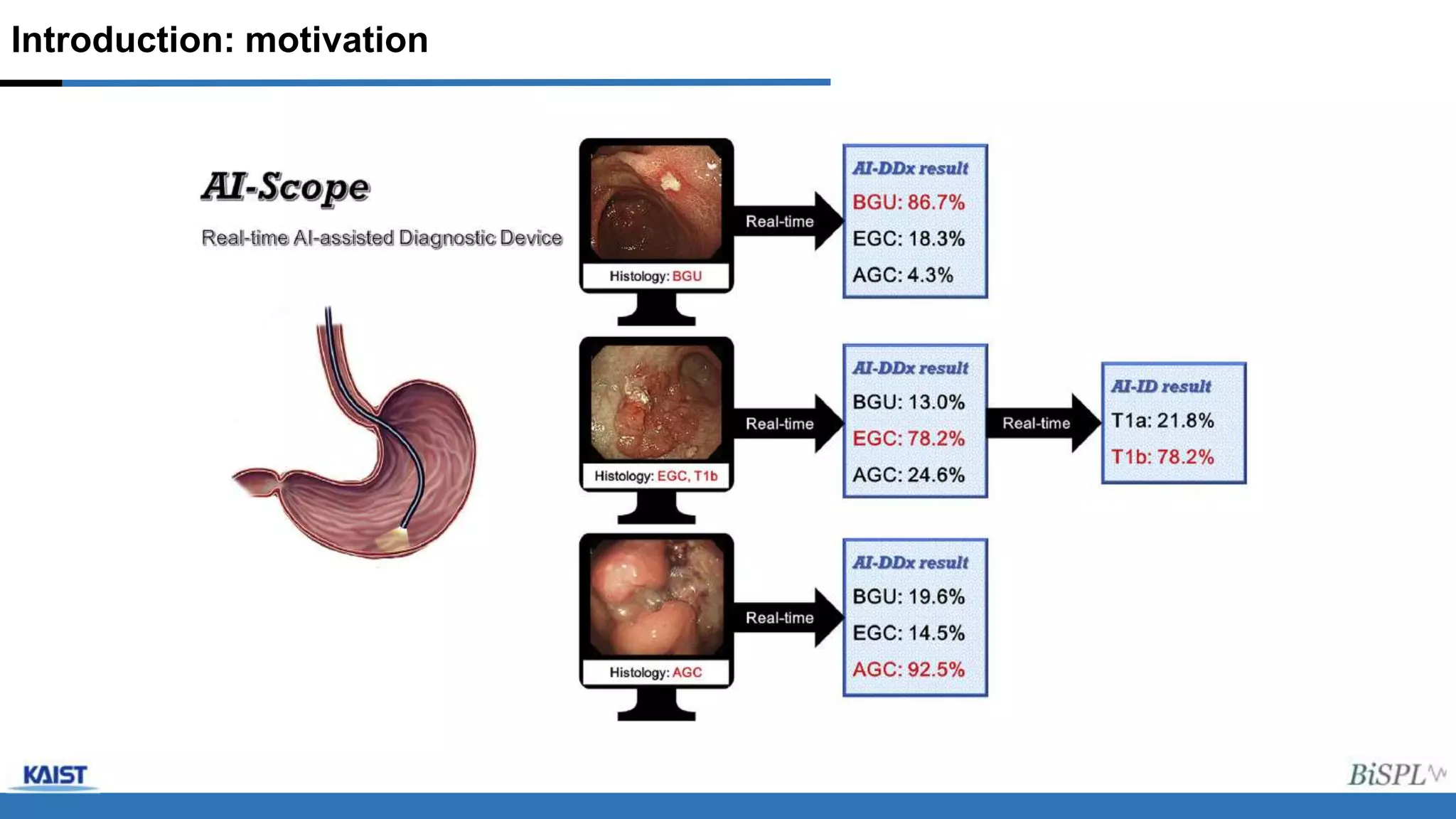 A deep learning model for diagnosing gastric mucosal lesions using ...