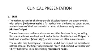 Dermatomyositis PPT | PPTX