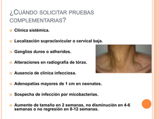 Adenitis cervical | PPTX