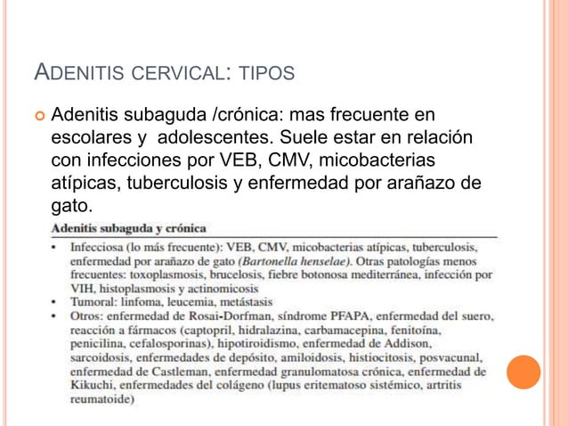 Adenitis cervical | PPTX