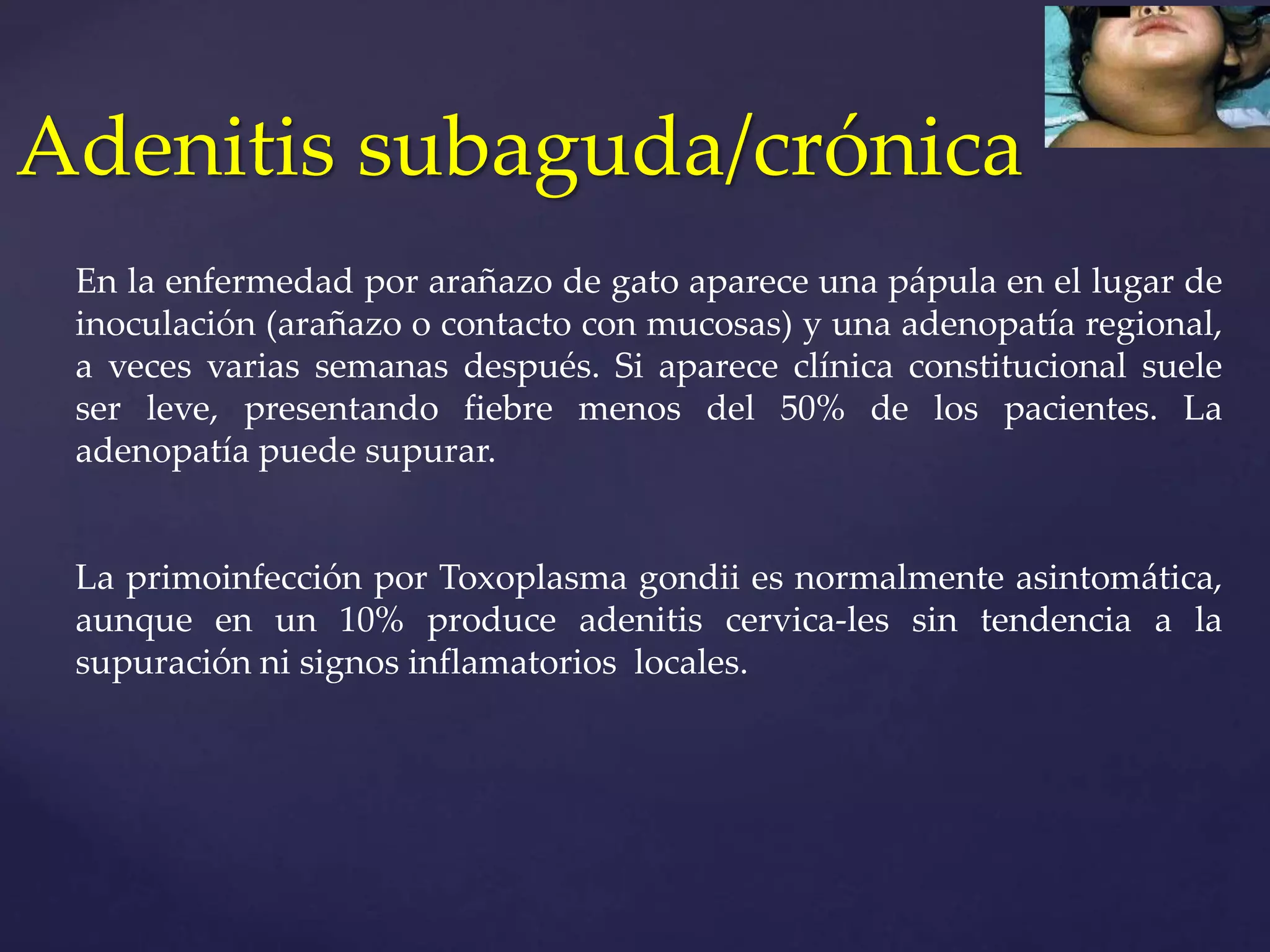 Adenitis Cervical | PPTX