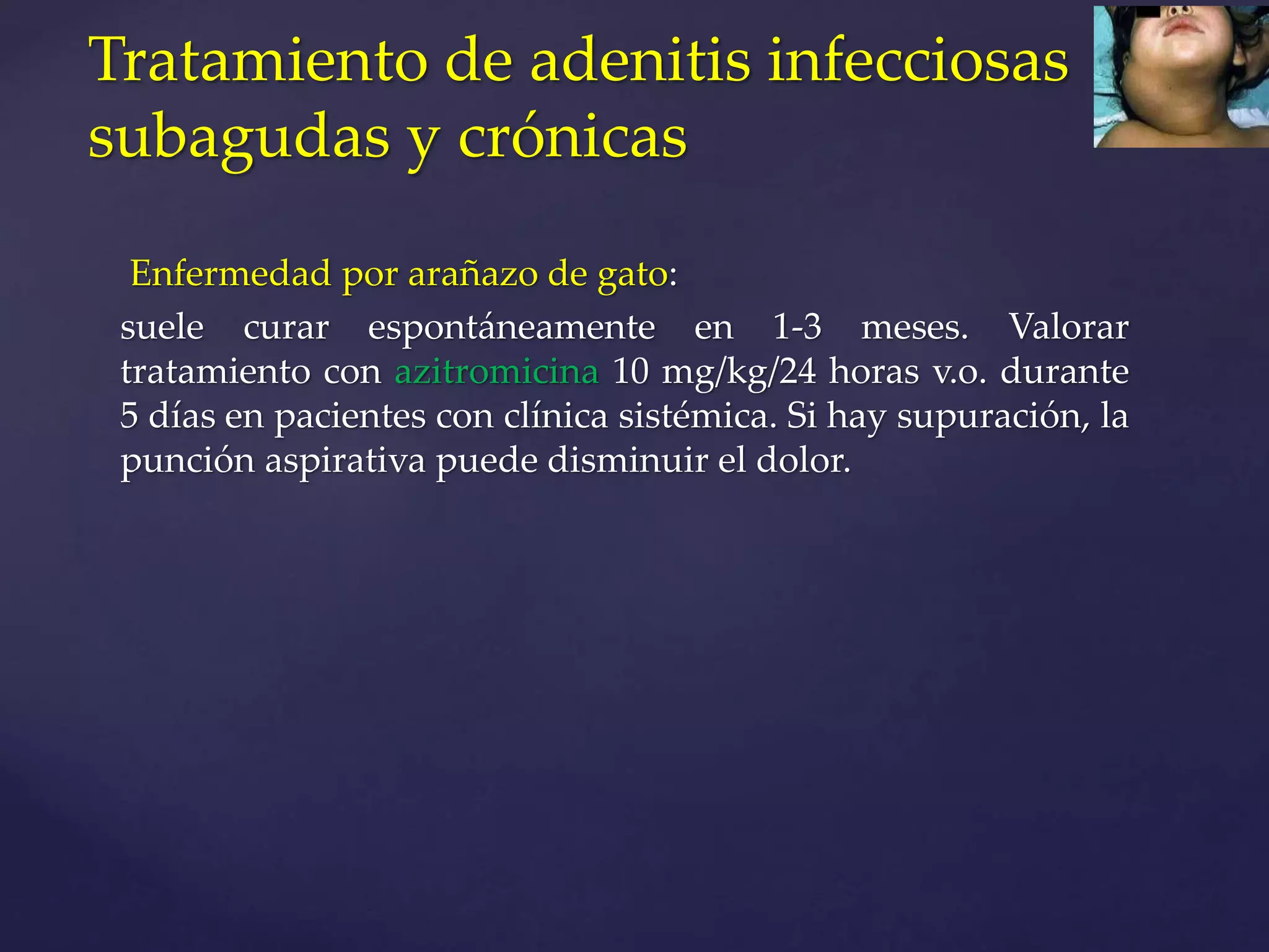 Adenitis Cervical | PPTX
