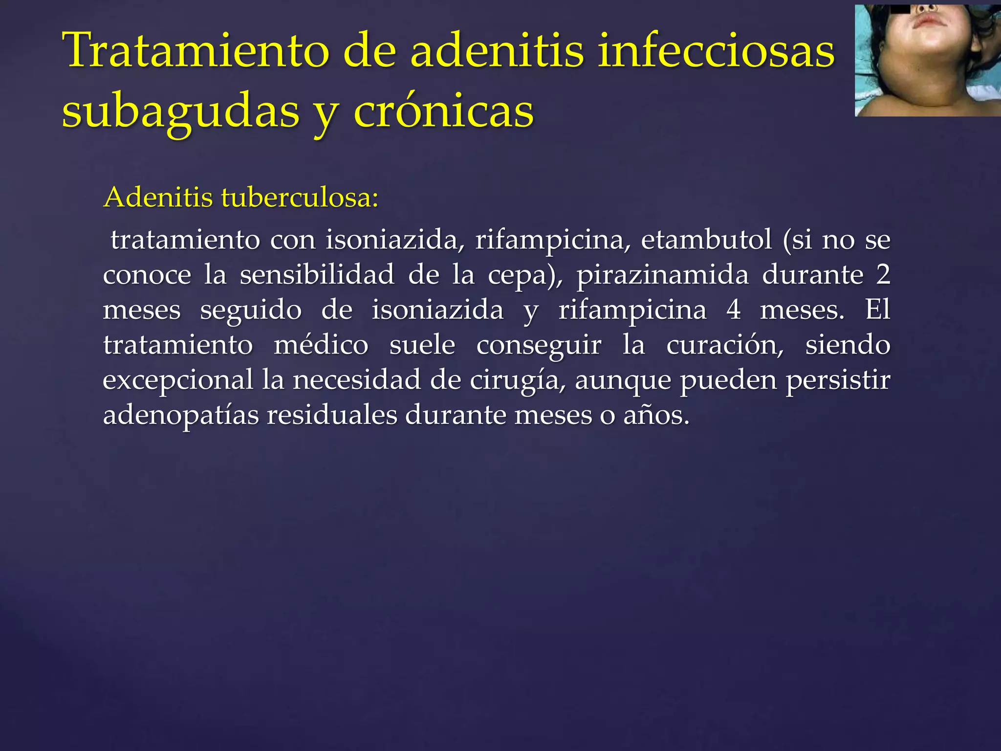 Adenitis Cervical | PPTX