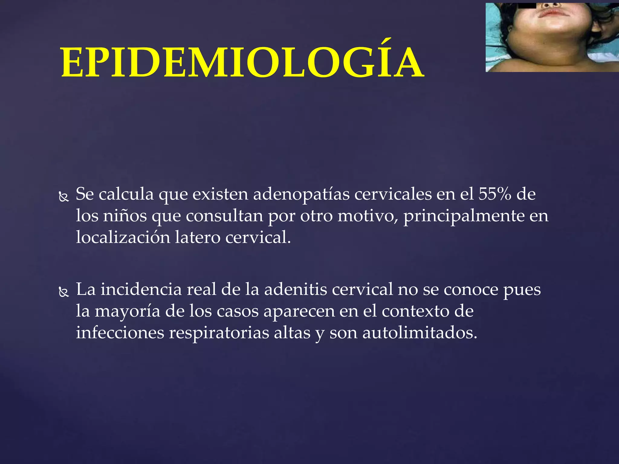 Adenitis Cervical | PPTX