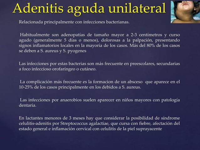 Adenitis Cervical | PPTX