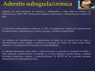 Adenitis Cervical | PPTX