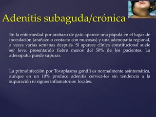 Adenitis Cervical | PPTX