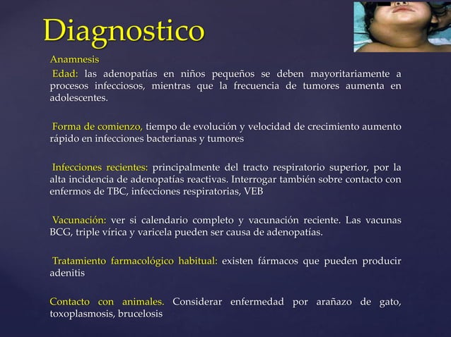 Adenitis Cervical | PPTX