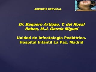 Adenitis Cervical | PPTX
