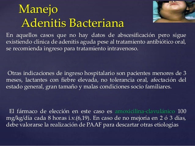 Adenitis Cervical