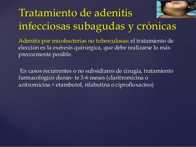 Adenitis Cervical