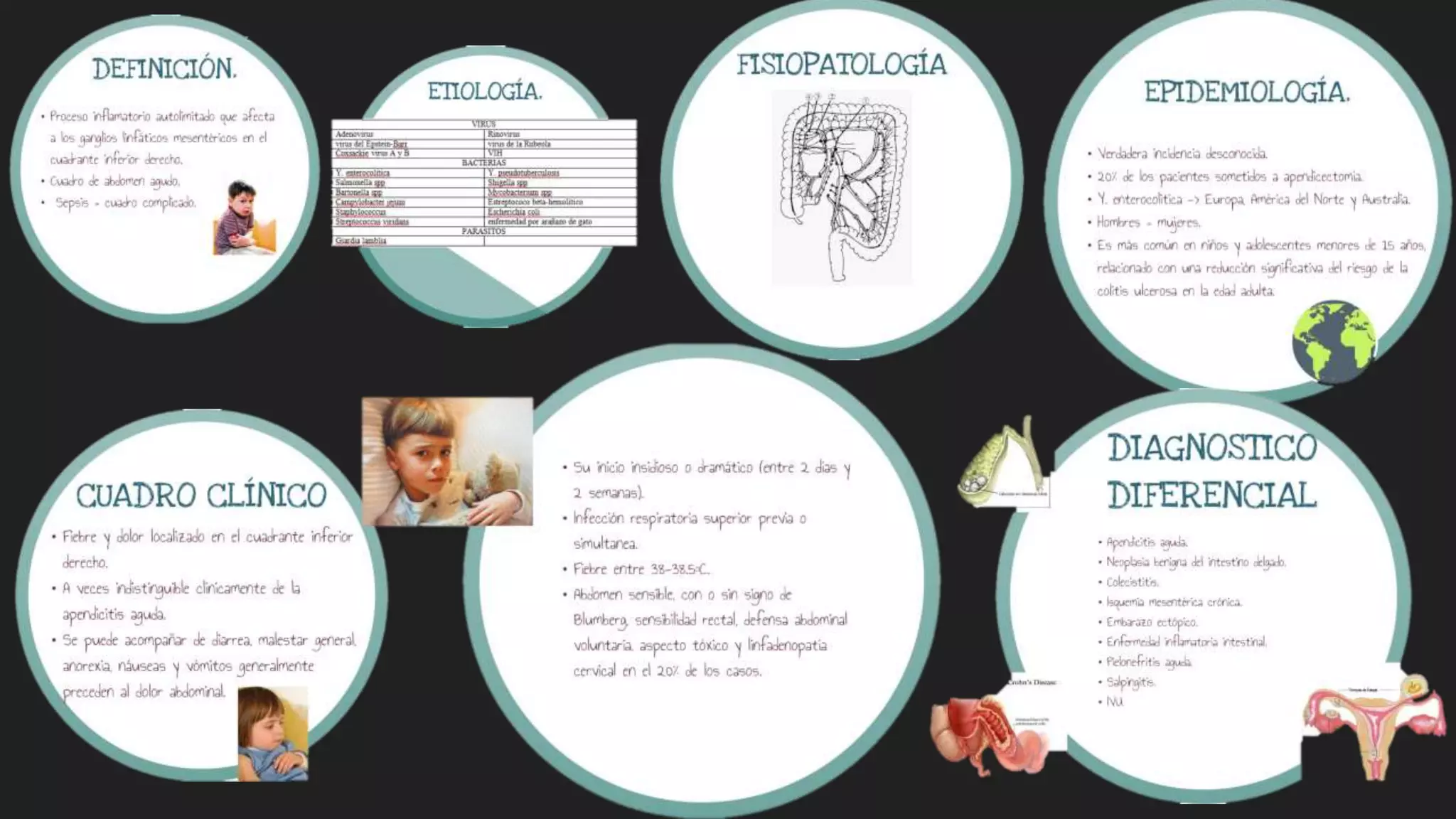 ADENITIS MESENTERICA.pptx
