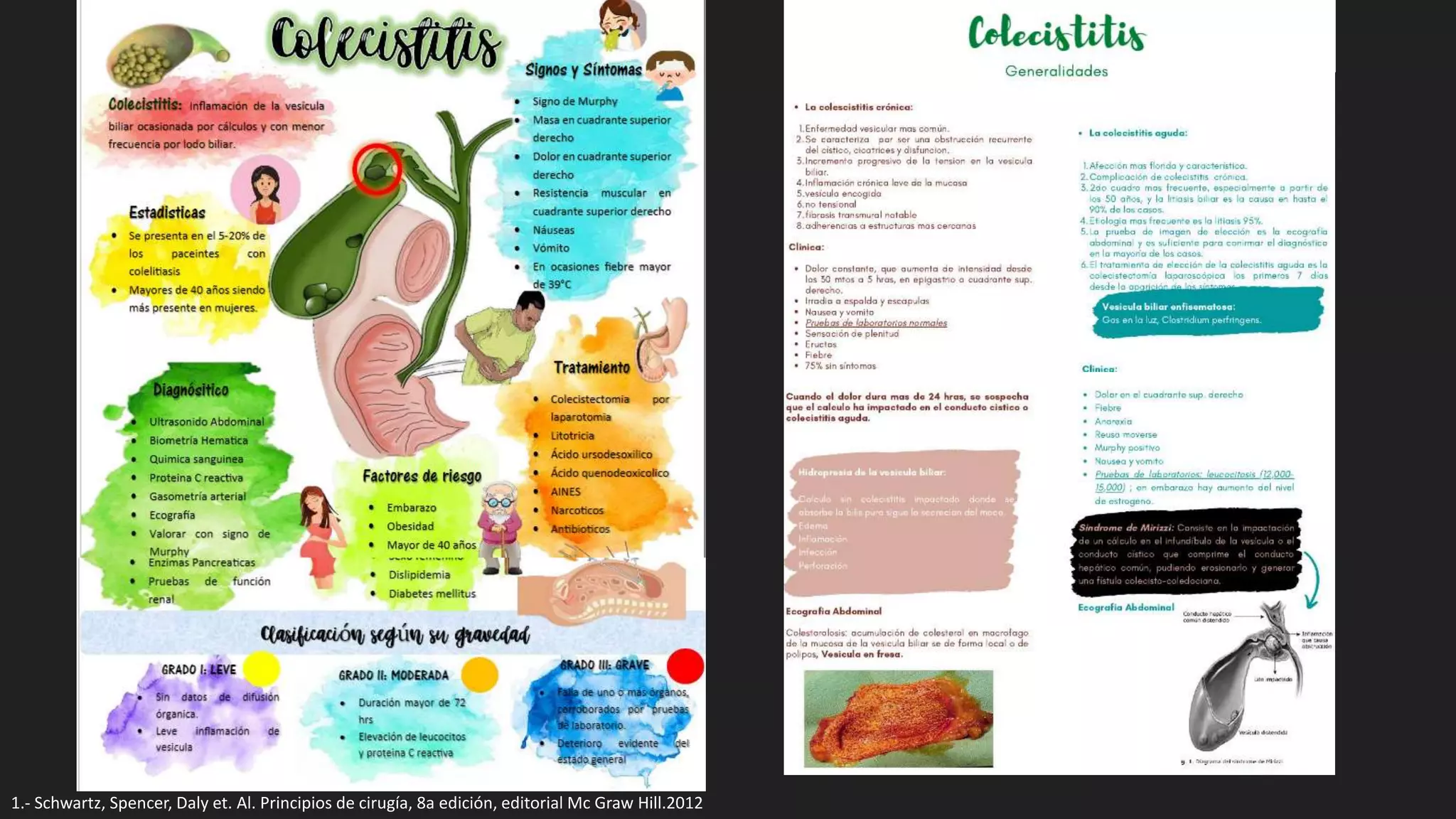 ADENITIS MESENTERICA.pptx