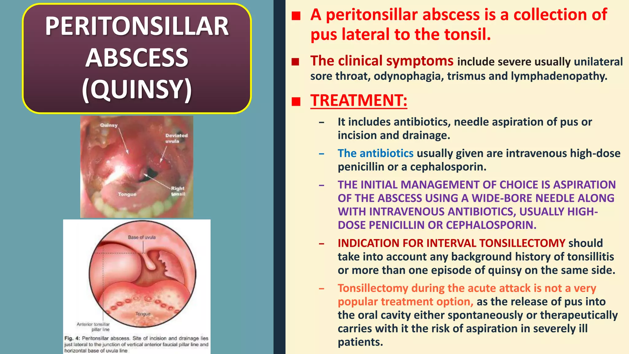 Adeno tonsillar diseases | PPTX