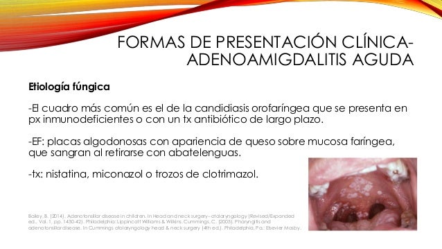 Adenoamigdalitis aguda y crónica