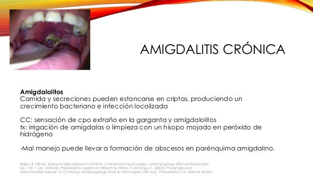 Adenoamigdalitis aguda y crónica