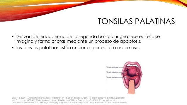 Adenoamigdalitis aguda y crónica