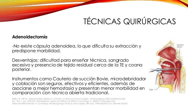 Adenoamigdalitis aguda y crónica