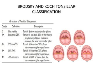 heyyyAdenoditis & Tonsilitis Updated.pptx