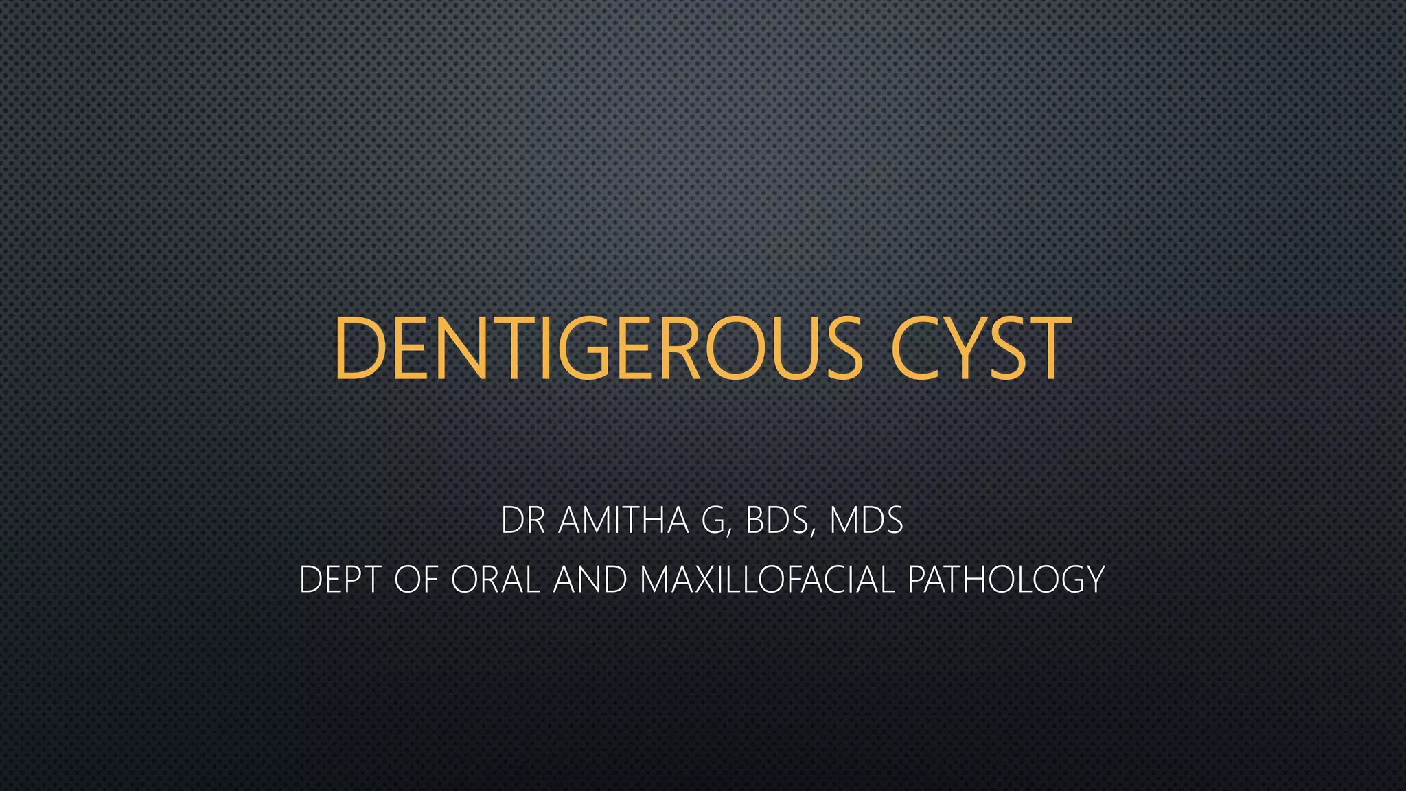 Dentigerous Cyst Definition | What Causes Dentigerous Cysts – NTQIR
