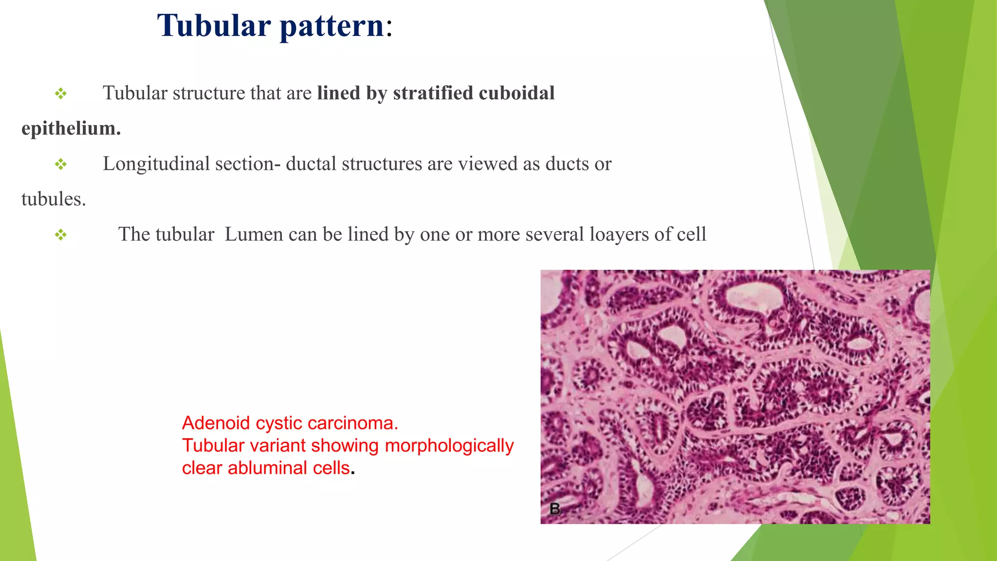 Adenoid cystic carcinoma | PPTX