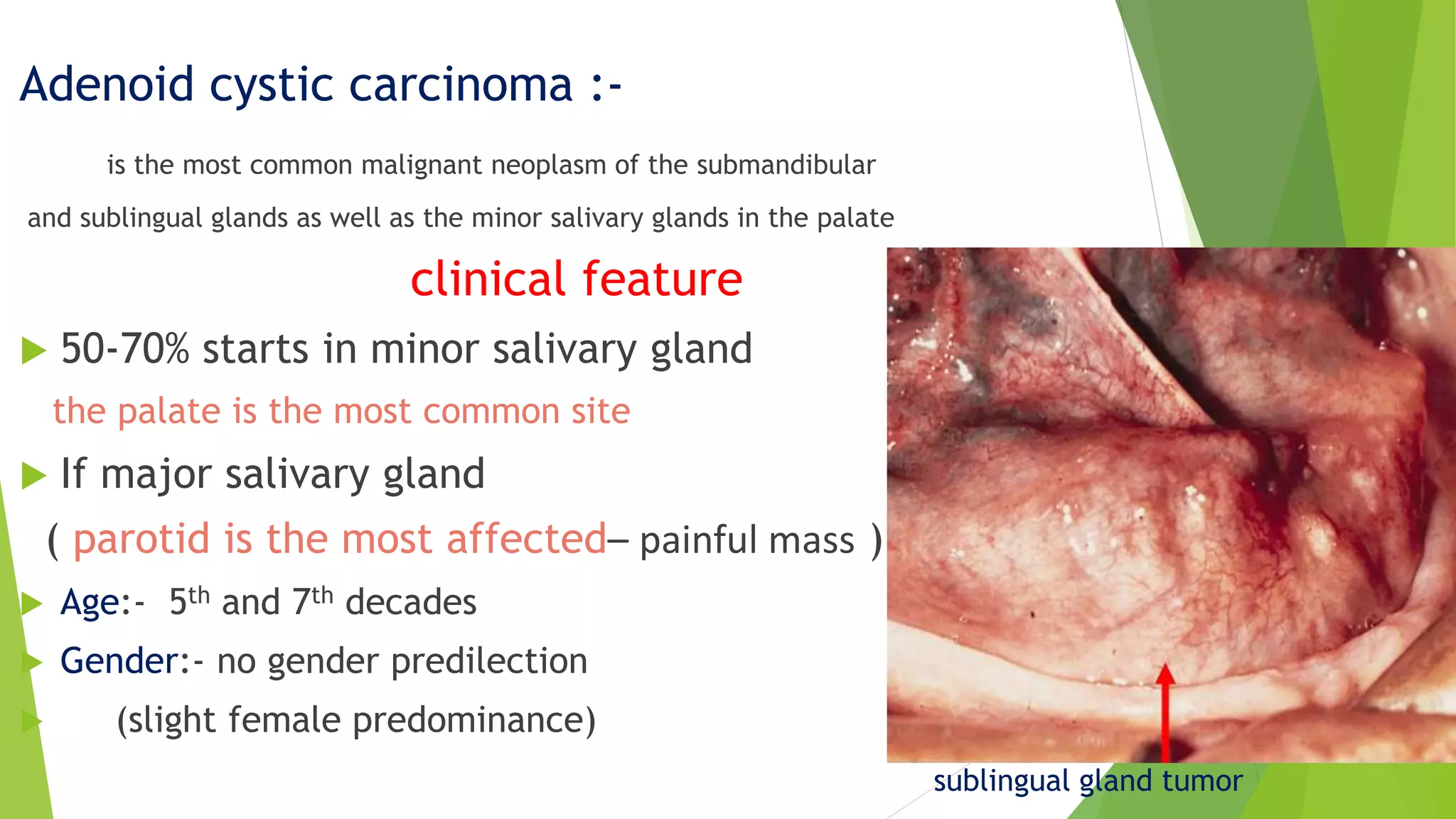 Adenoid cystic carcinoma | PPTX