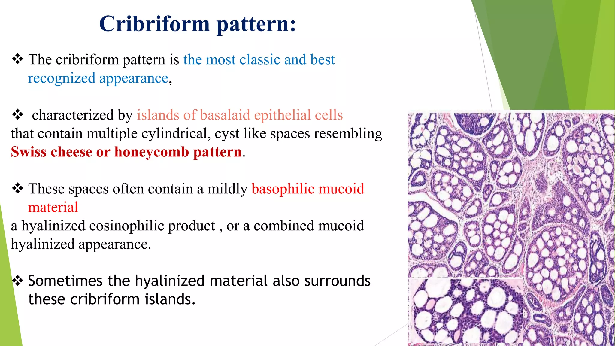 Adenoid cystic carcinoma | PPTX