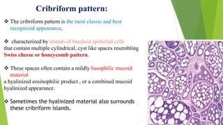 Adenoid cystic carcinoma | PPTX