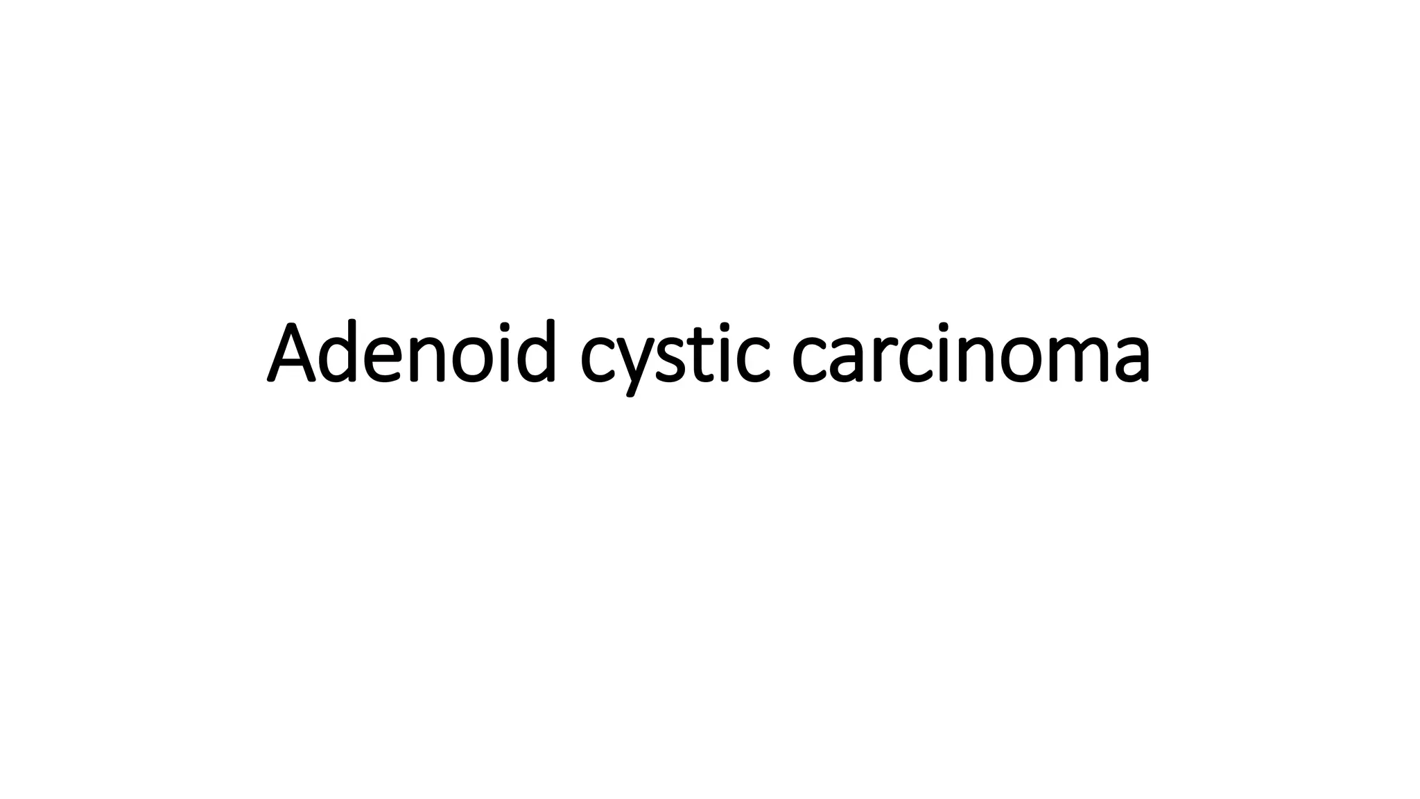 Adenoid cystic carcinoma: salivary gland | PDF