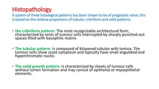 Adenoid cystic carcinoma: salivary gland | PDF