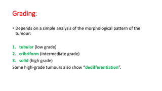 Adenoid cystic carcinoma: salivary gland | PDF