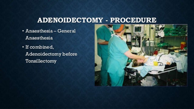 Adenoidectomy and tonsillectomy