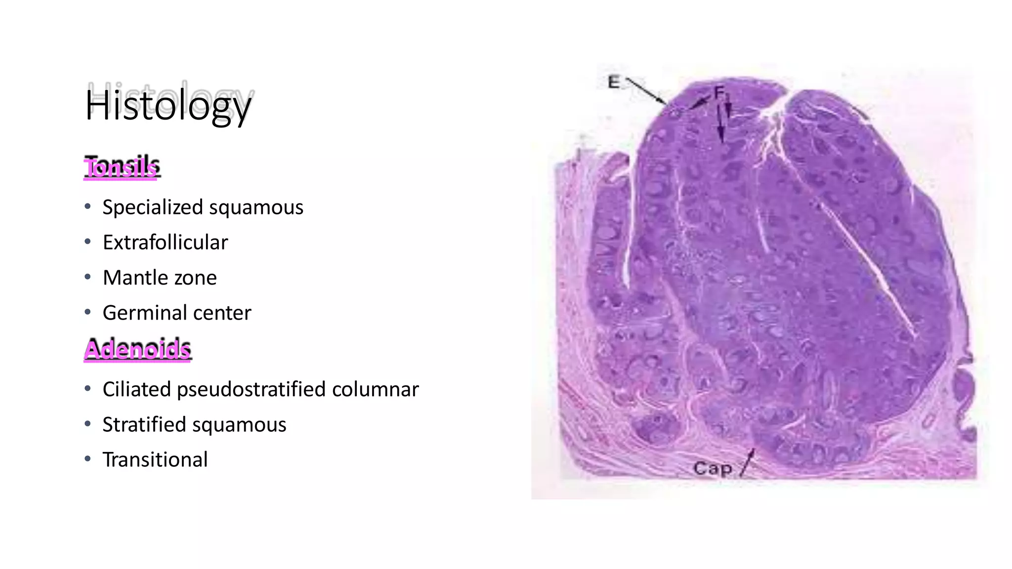 Adenoid Enlargement.pptx