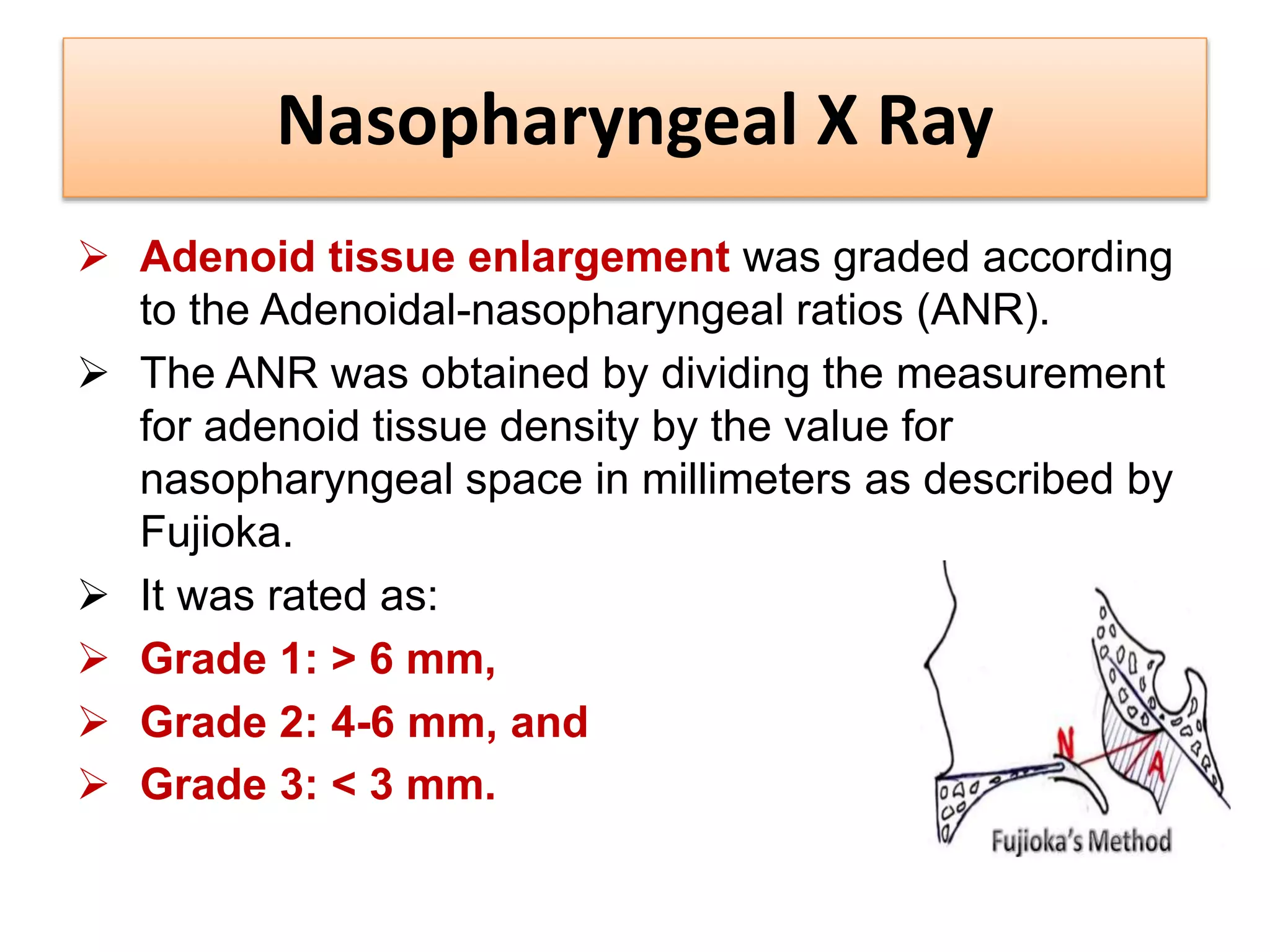 Adenoid Enlargement in children.pptx