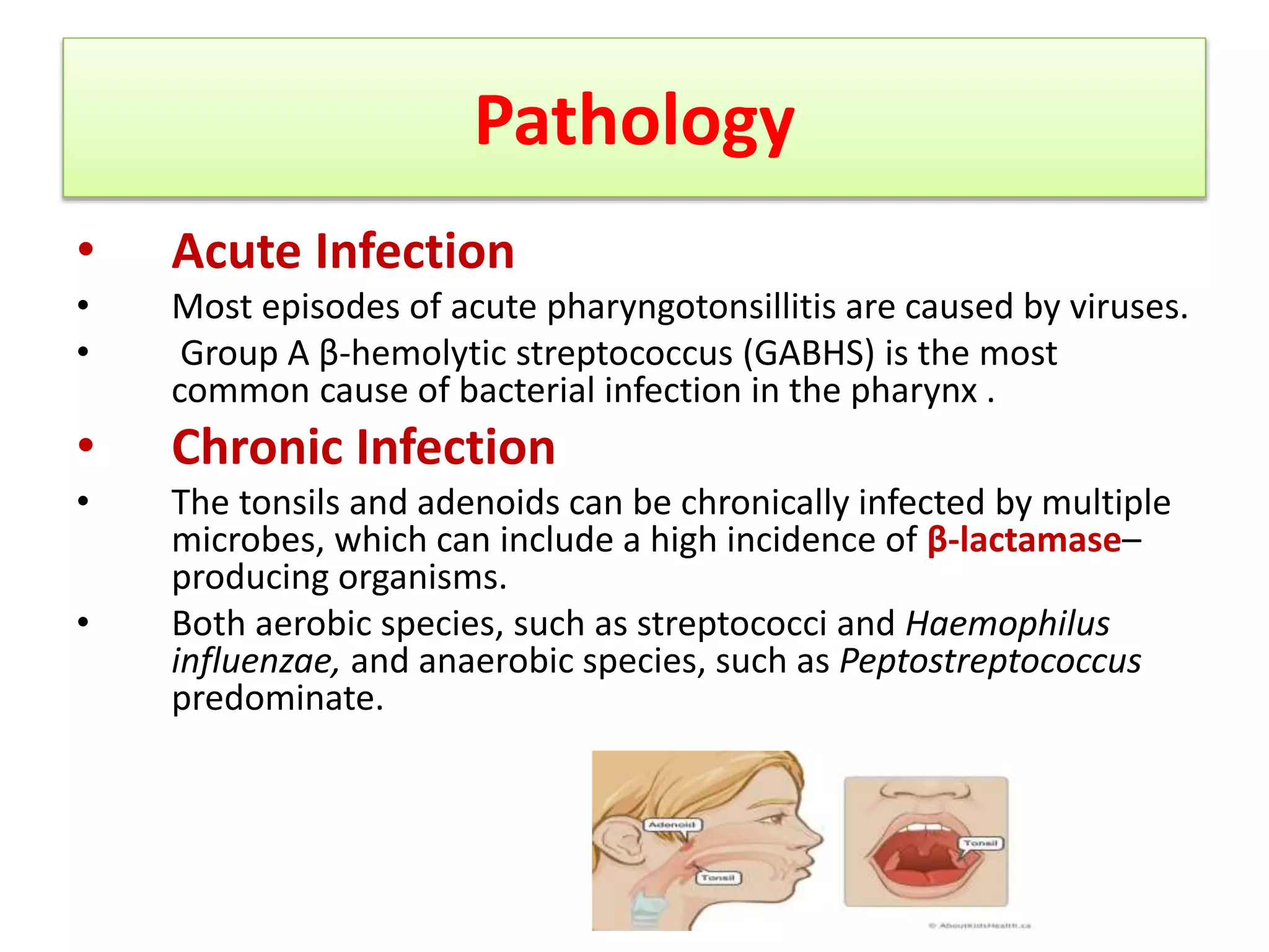Adenoid Enlargement in children.pptx