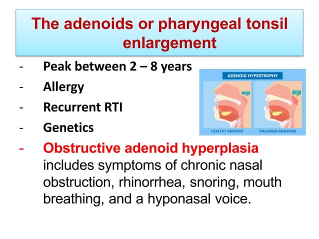 Adenoid Enlargement in children.pptx