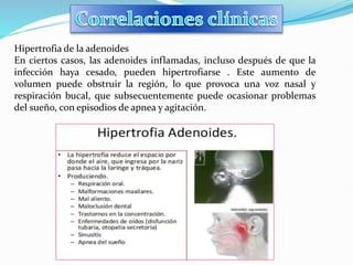adenoides.pptxhgdjhsgdfhshfsjhfgfghjfgdhf | PPT