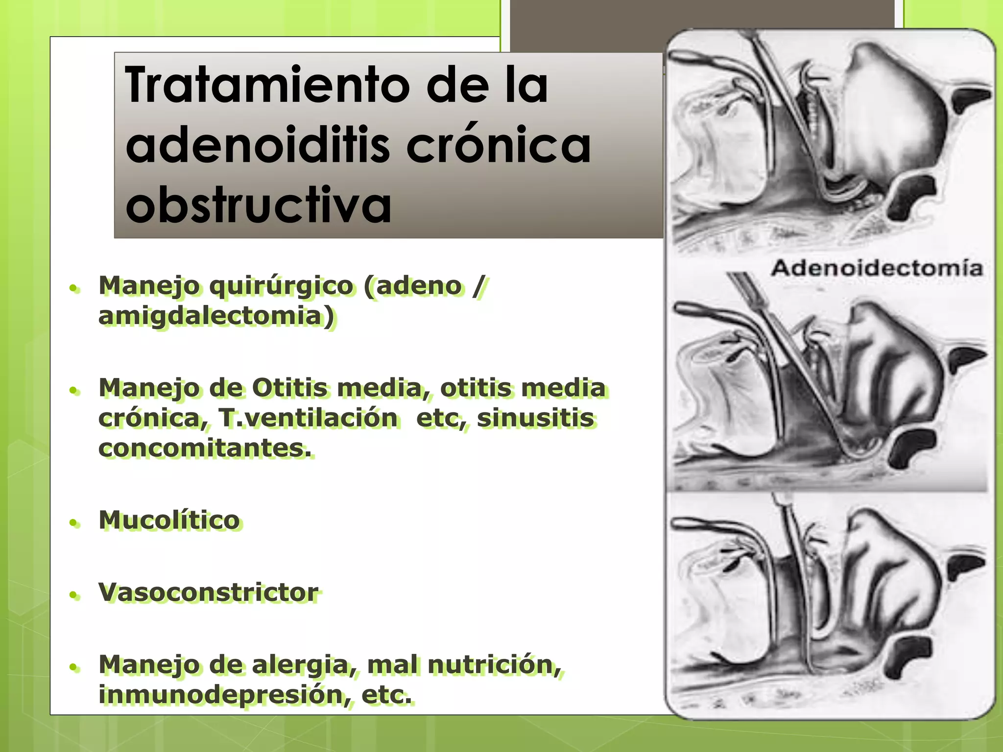 Adenoiditis | PPTX