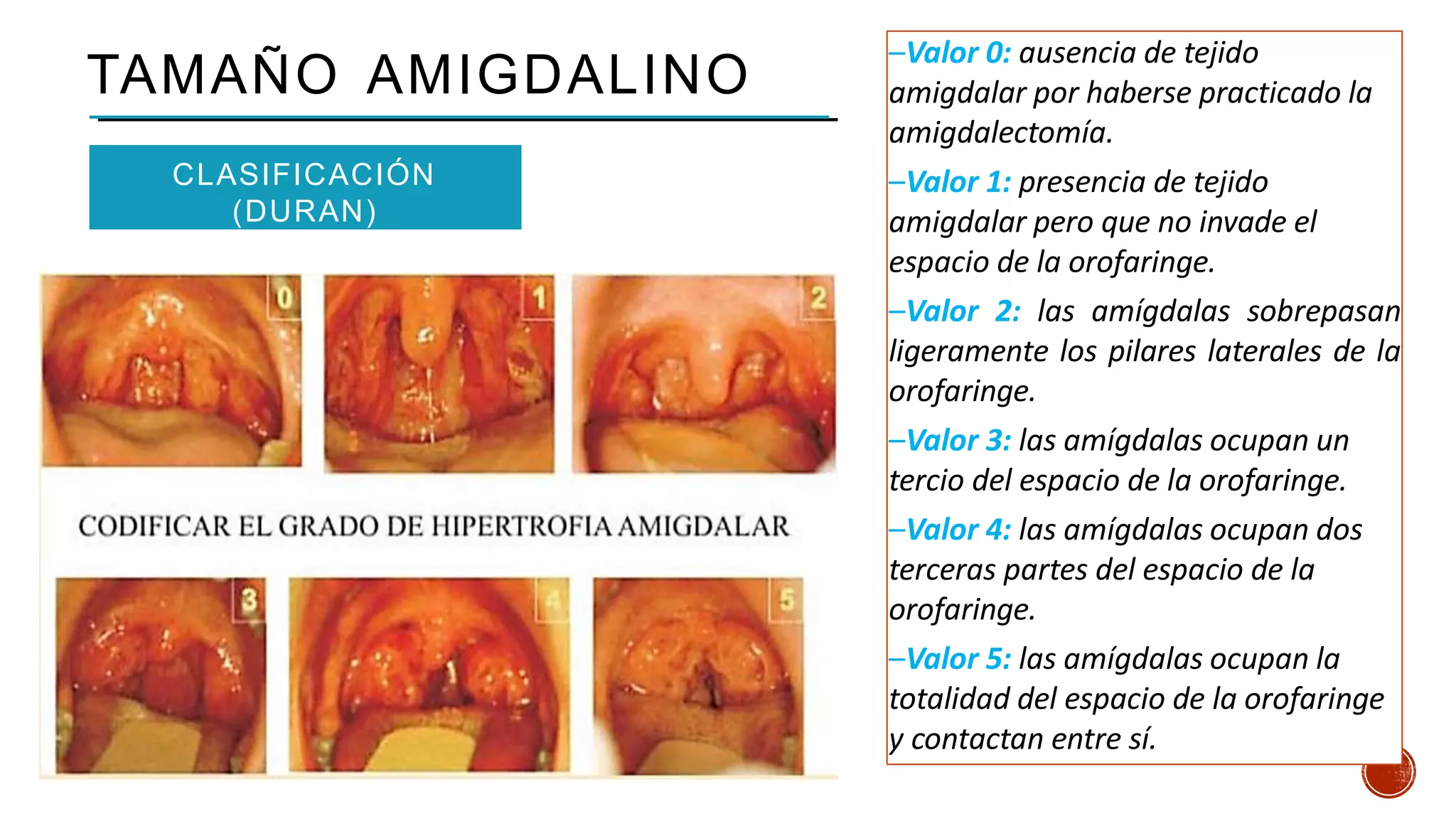 Adenoiditis, Amigdalitis, Adenoidectomía y Amigdalectomía | PPTX