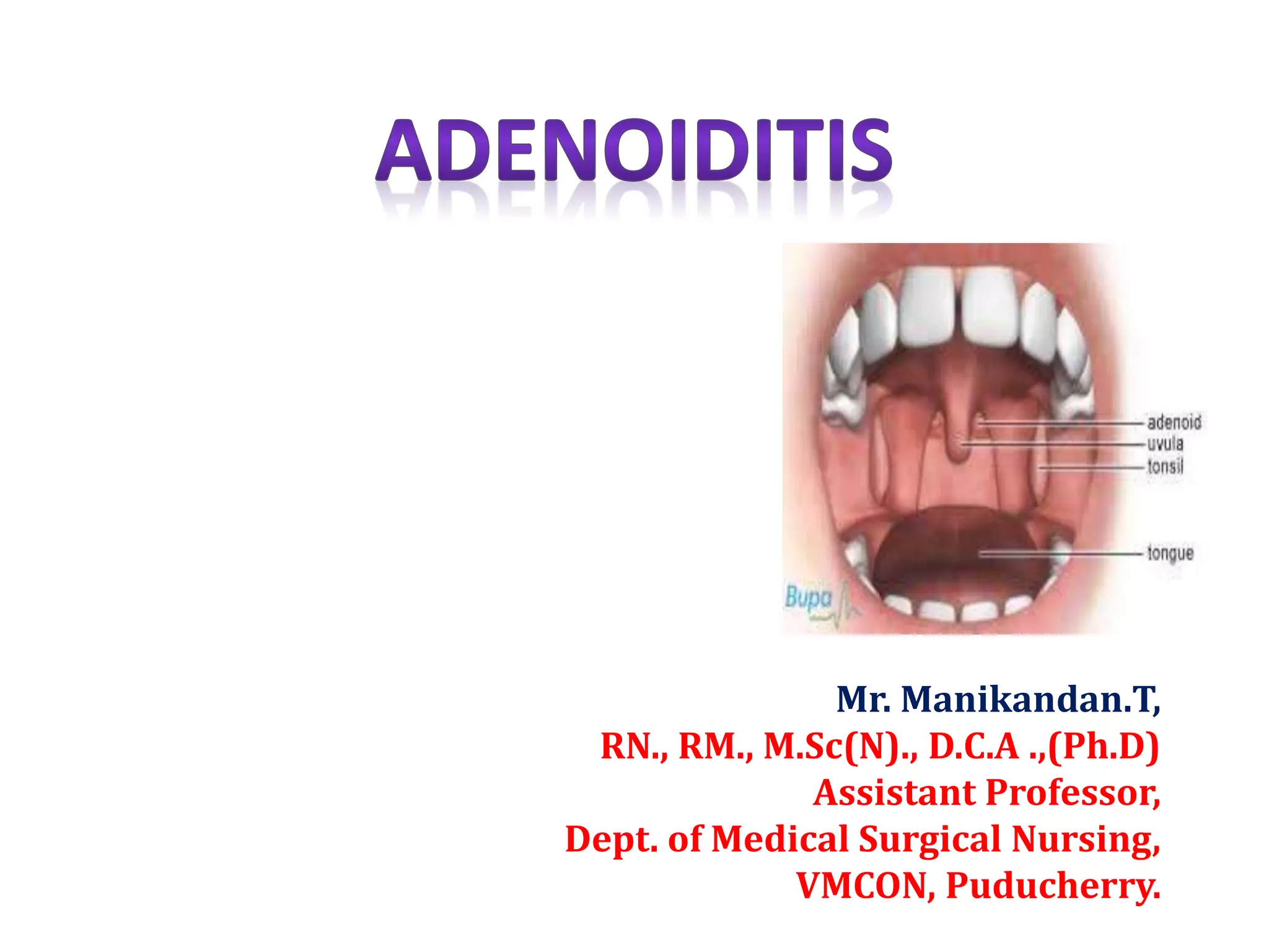 Adenoiditis | PPT