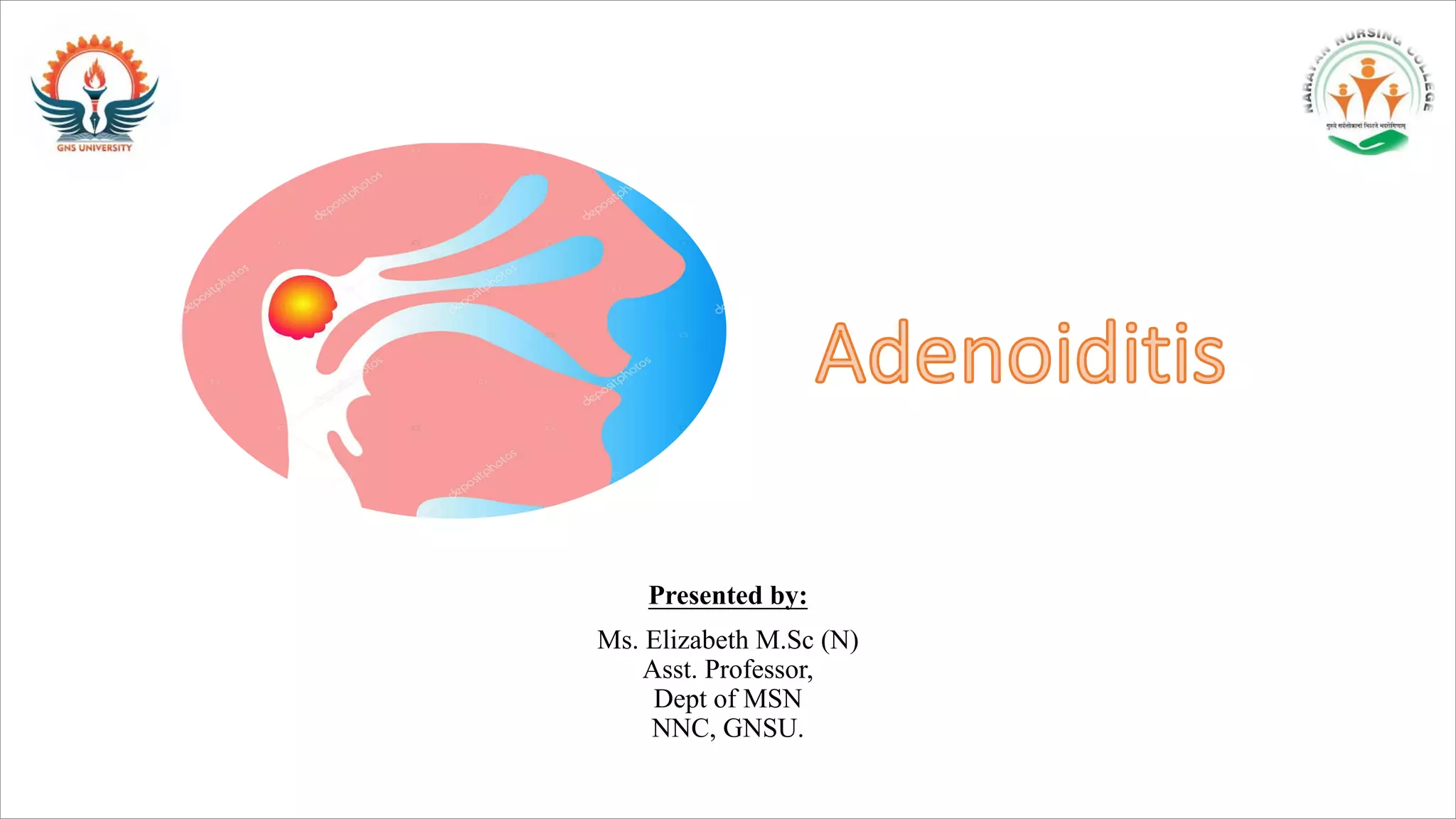 Adenoiditis - easy explanation for nursing students | PDF