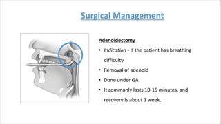 Adenoiditis - easy explanation for nursing students | PDF