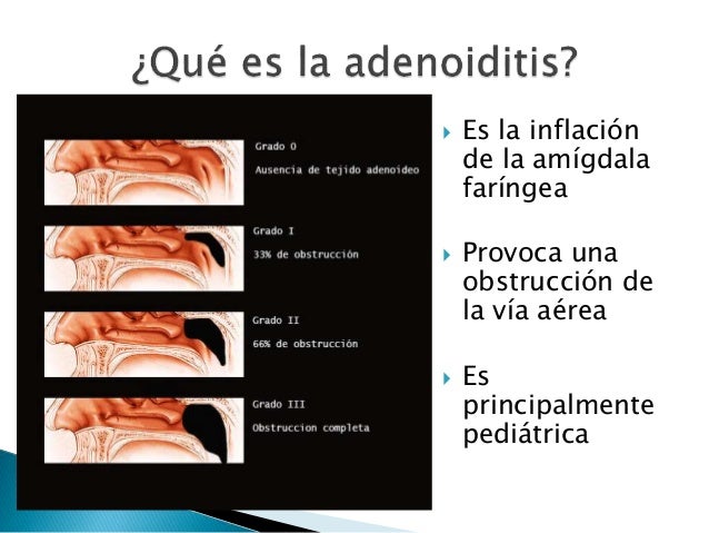 Adenoiditis