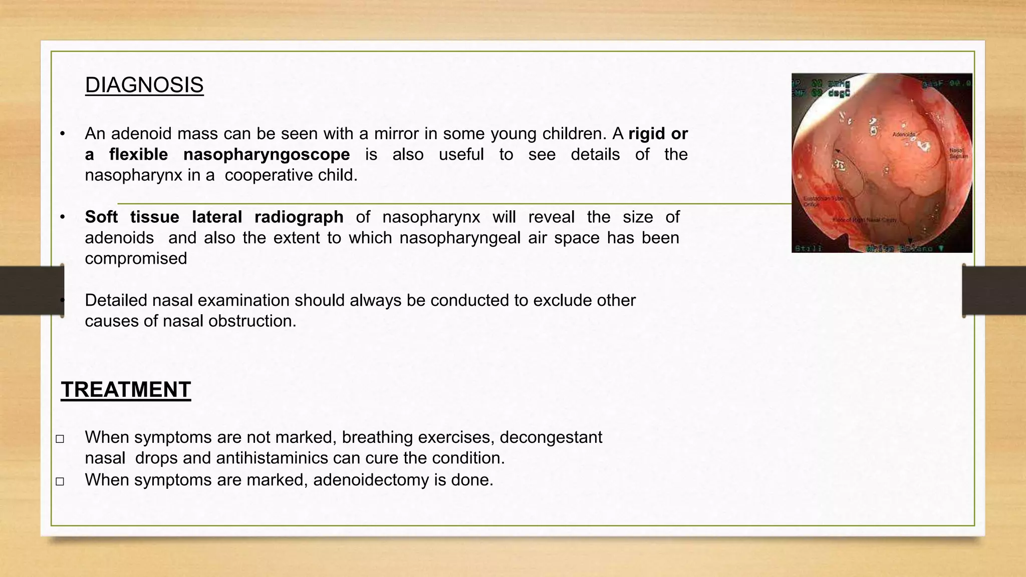 Adenoiditis & Adenoidectomy | PPTX
