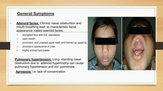 Adenoiditis & Adenoidectomy | PPTX
