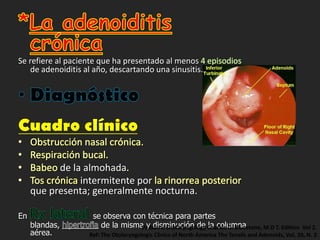 Adenoiditis e ha | PPTX