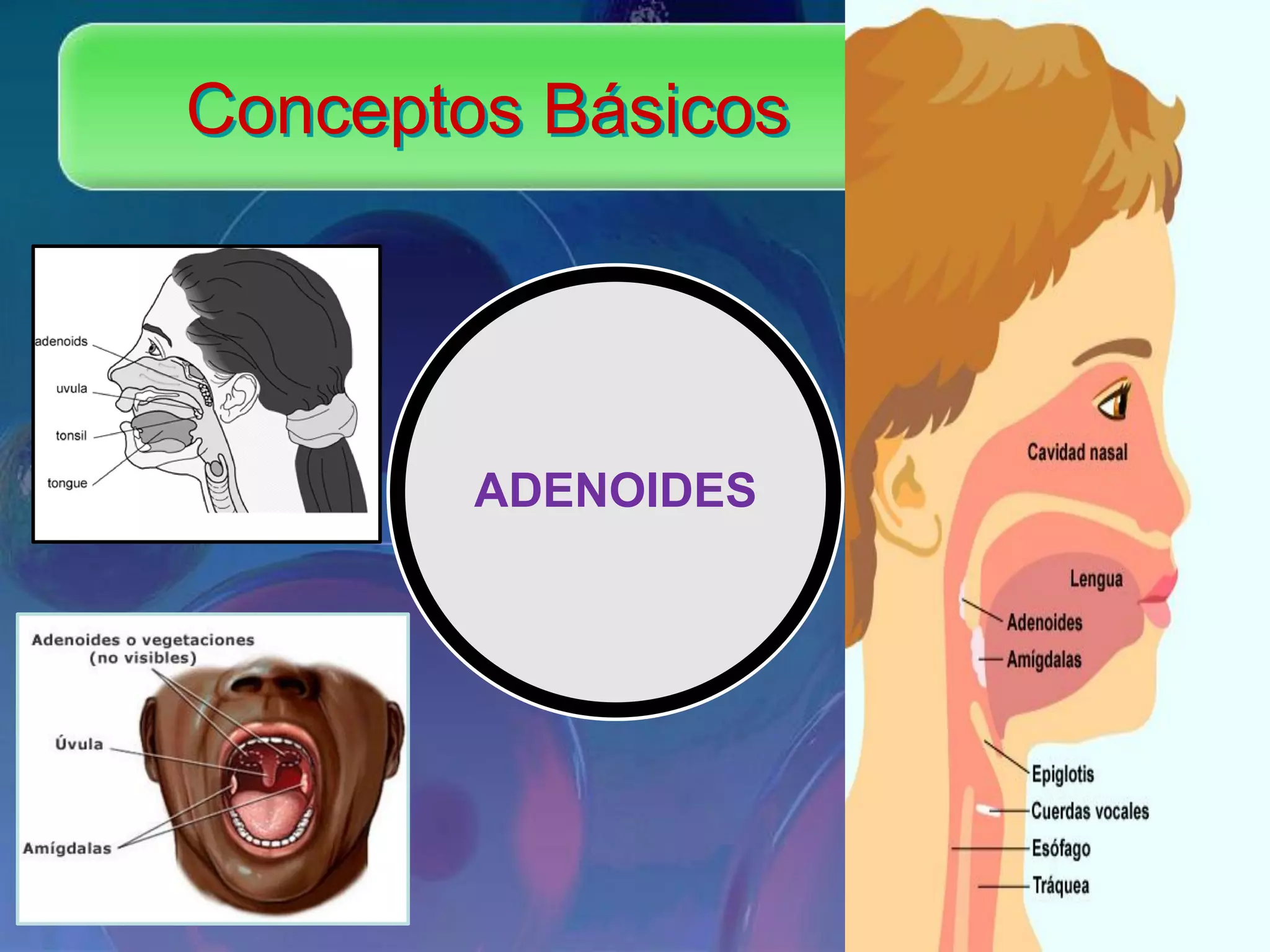 Adenoiditis y rinitis | PDF | Ear, Nose and Throat Conditions ...